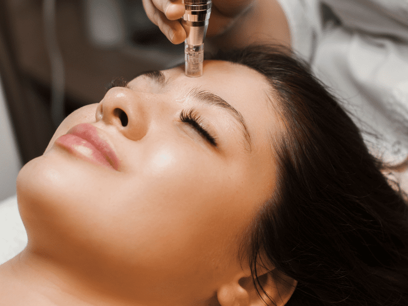 Formation microneedling en ligne